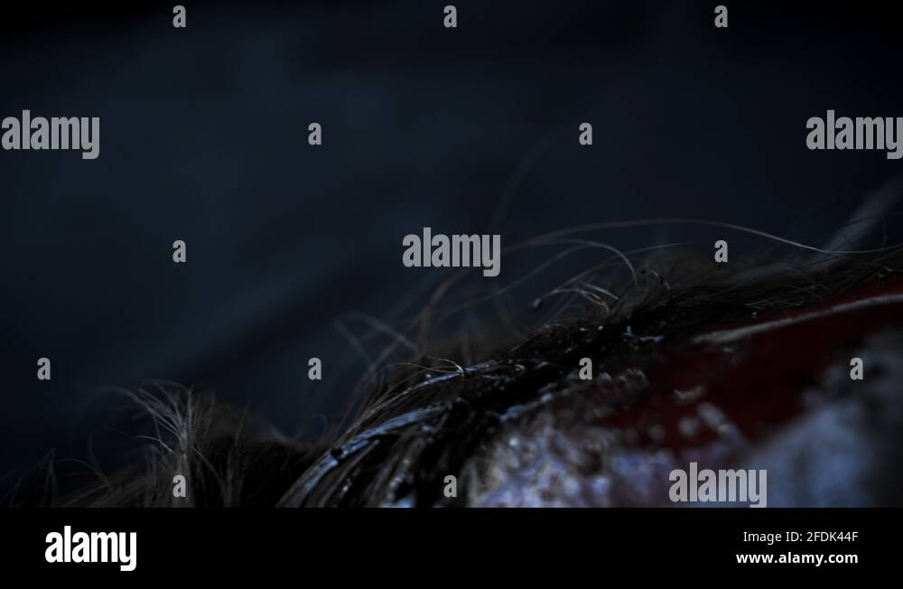 4k Dead Human Body Cadaver Laying Killed in Blood Stock Video Footage ...