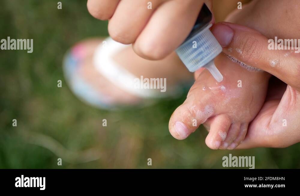 Hydrogen peroxide bubbles Stock Videos & Footage - HD and 4K Video ...