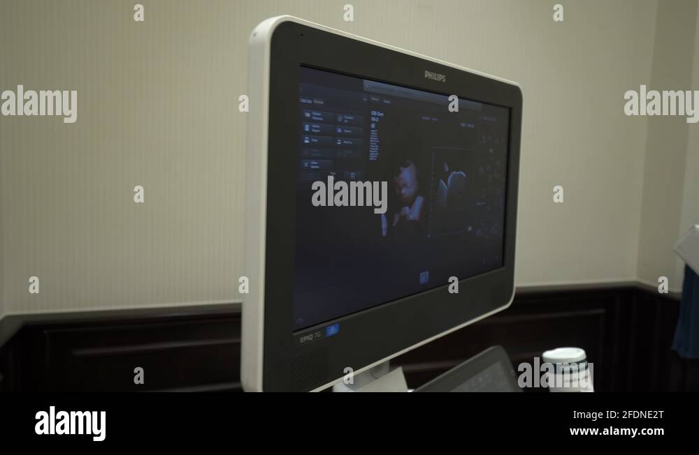 Fetal image Stock Videos & Footage - HD and 4K Video Clips - Alamy