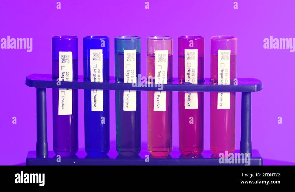 Coloured test tubes Stock Videos & Footage - HD and 4K Video Clips - Alamy