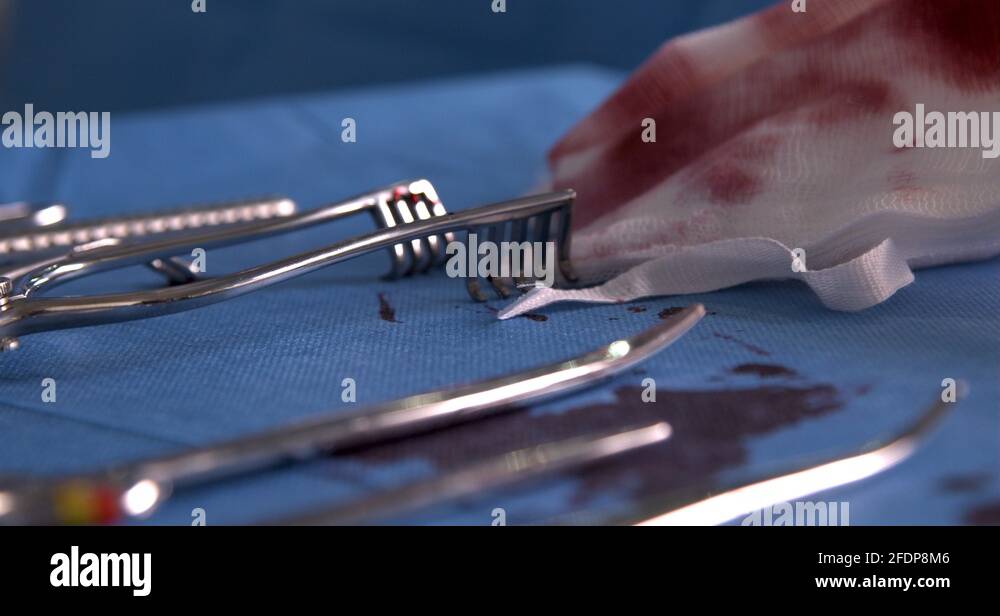 Worker putting surgical instruments Stock Videos & Footage - HD and 4K ...