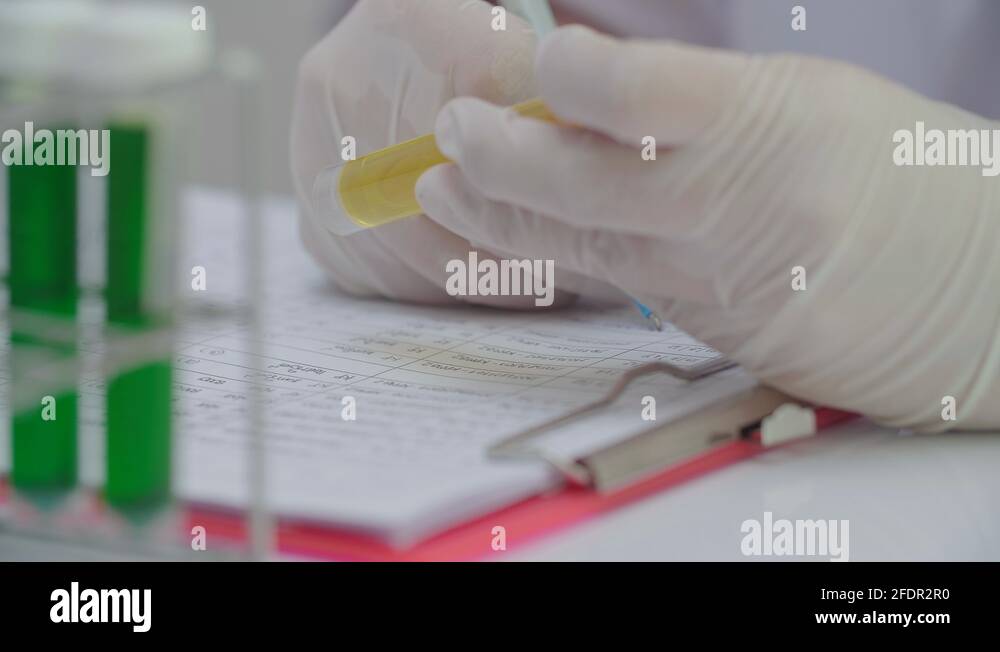 Scientist wearing white gloves writing analysis of a chemical sample in ...