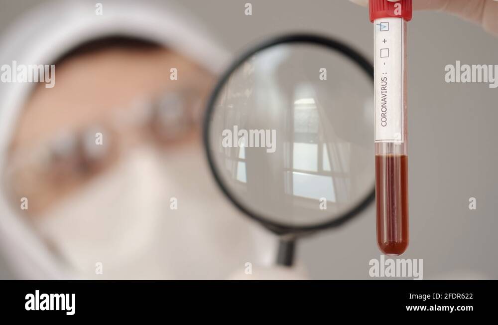 Male scientist is examining a blood test with a magnifying glass Stock ...