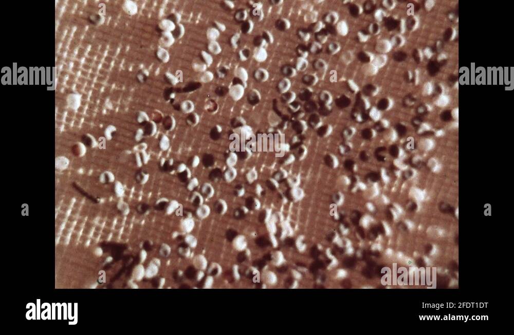 Hatching larvae Stock Videos & Footage - HD and 4K Video Clips - Alamy