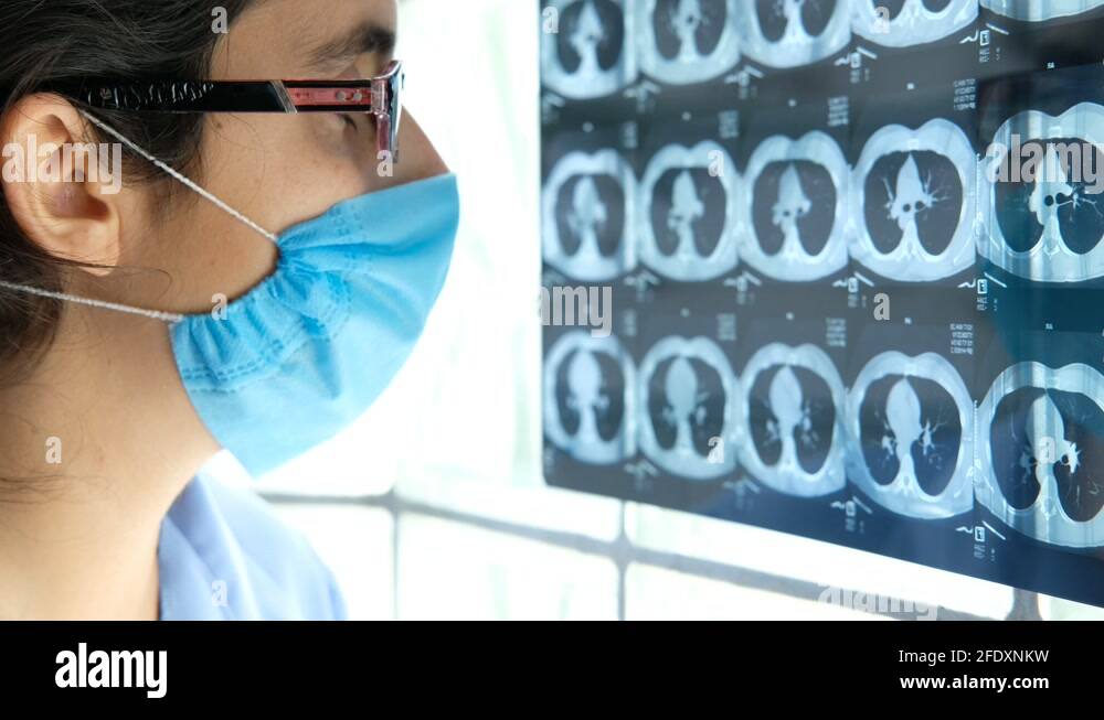 Woman chest x ray Stock Videos & Footage - HD and 4K Video Clips - Alamy