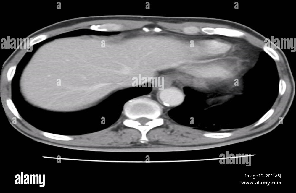 Abdomen axial mri scan Stock Videos & Footage - HD and 4K Video Clips ...