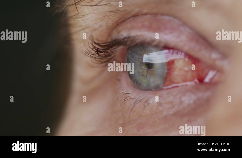 Wrinkled correction Stock Videos & Footage - HD and 4K Video Clips - Alamy