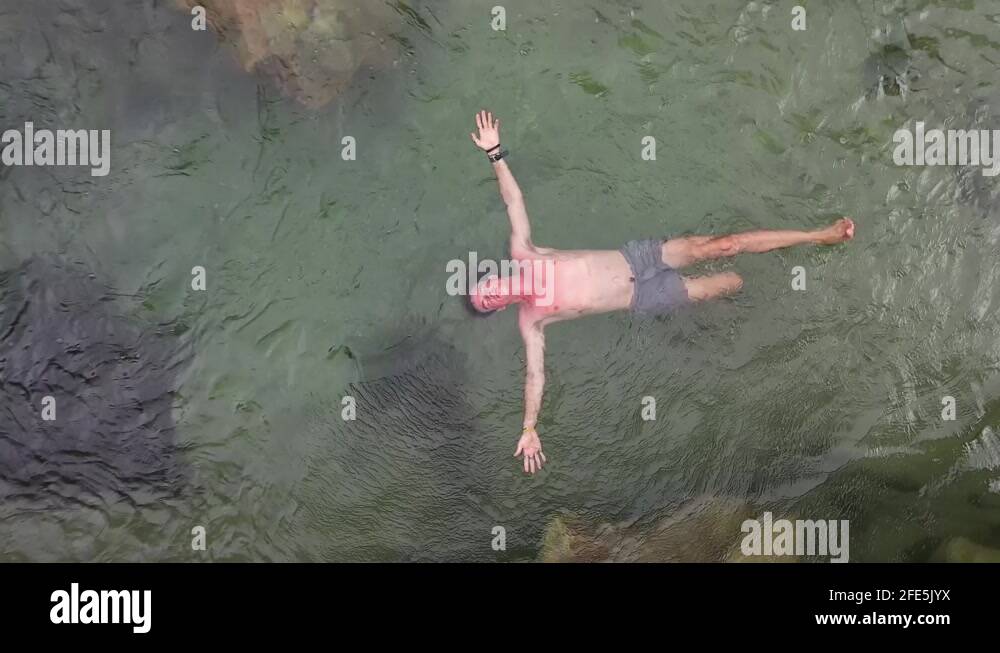 Man sunburnt Stock Videos & Footage - HD and 4K Video Clips - Alamy