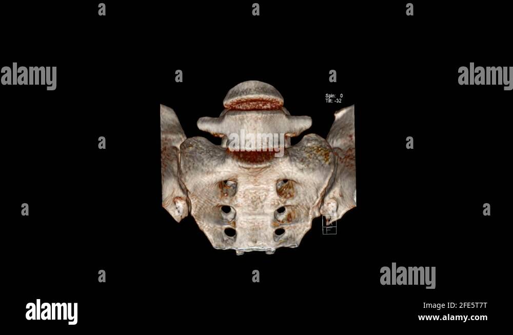 Human skeleton pelvic joints xray Stock Videos & Footage - HD and 4K ...