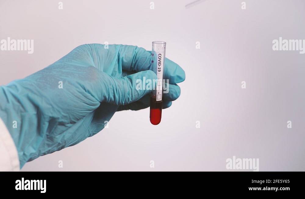 Extracting Blood Samples In A Tube Using Plastic Pipette Dropper For ...