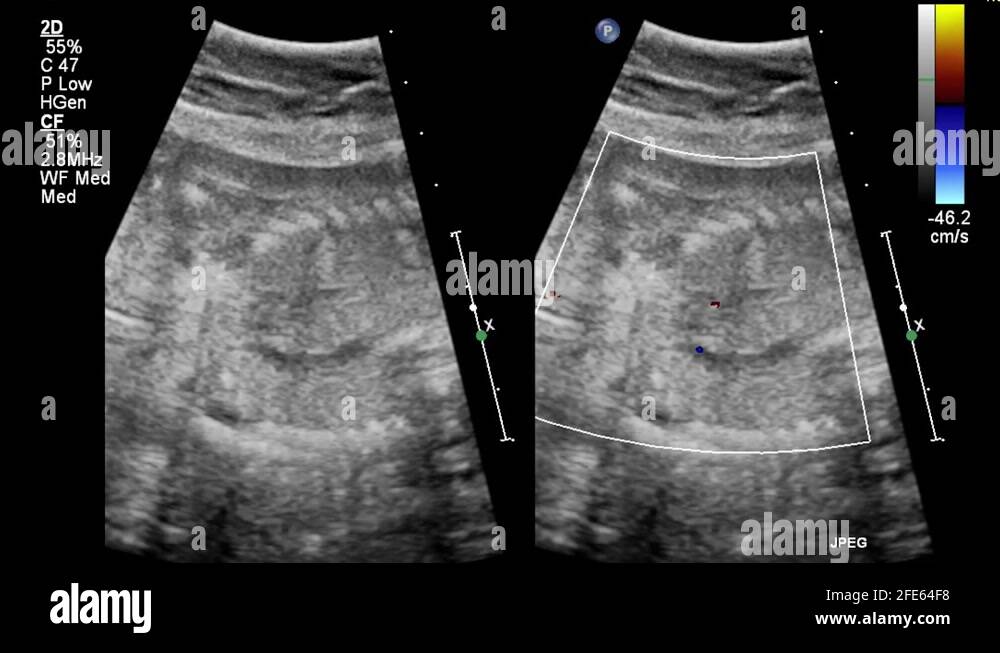 Fetal heart development Stock Videos & Footage - HD and 4K Video Clips ...
