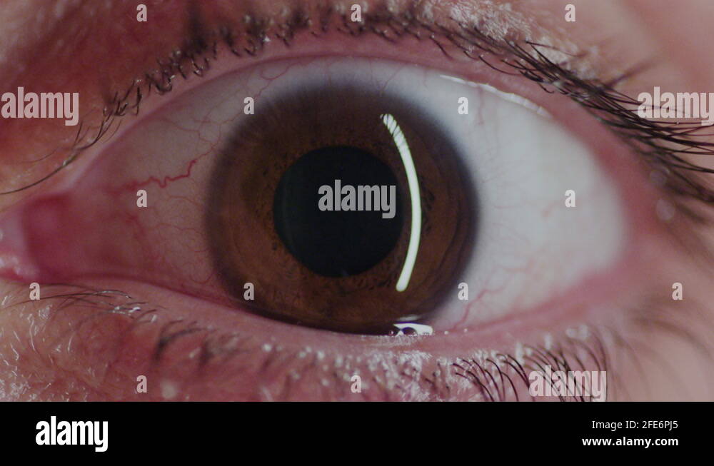 Eye blood vessels Stock Videos & Footage - HD and 4K Video Clips - Alamy