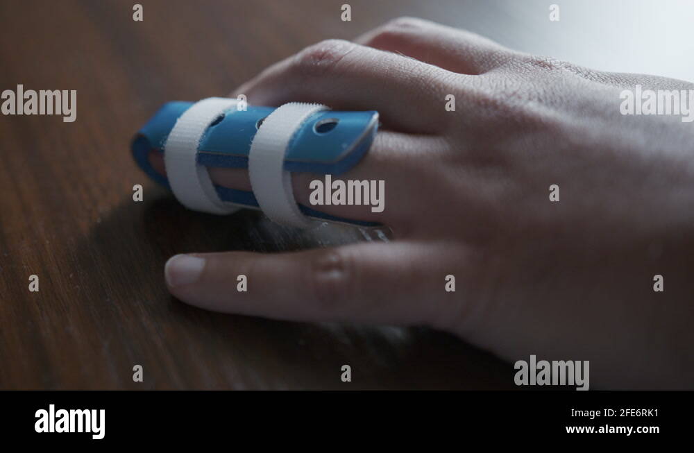 Splint bone Stock Videos & Footage - HD and 4K Video Clips - Alamy