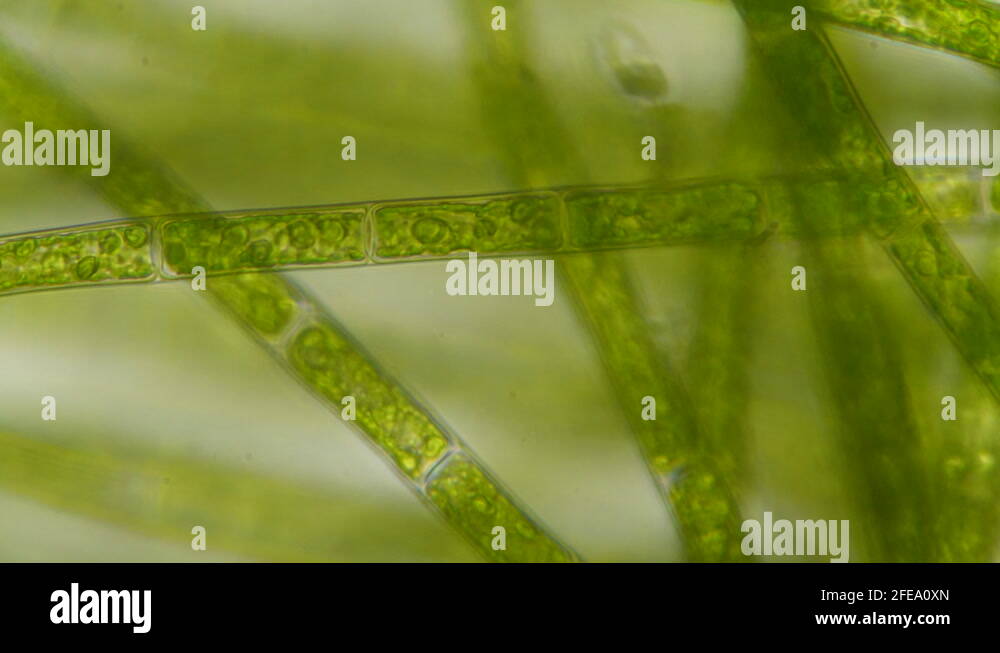 Chloroplast under a microscope. Cell division. Cell structure. Cell ...