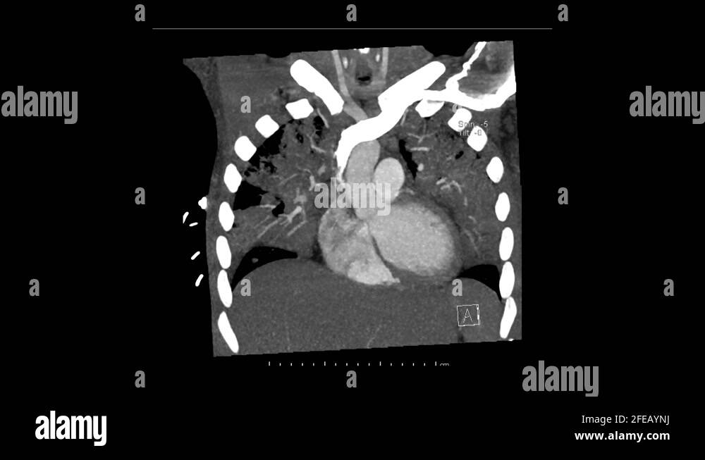 Coronal plane Stock Videos & Footage - HD and 4K Video Clips - Alamy
