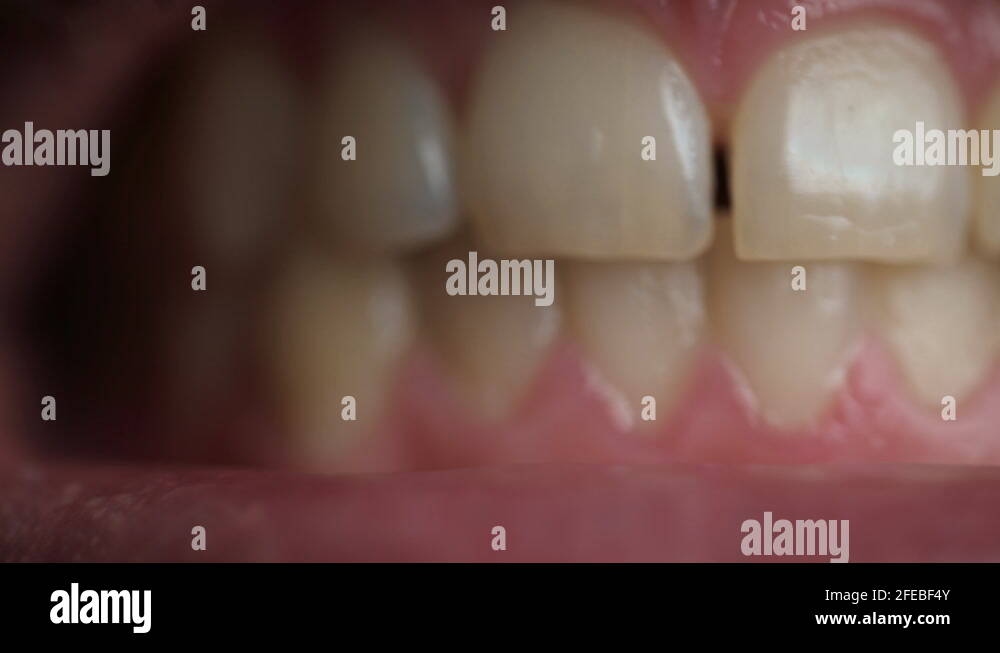 Grind teeth Stock Videos & Footage - HD and 4K Video Clips - Alamy