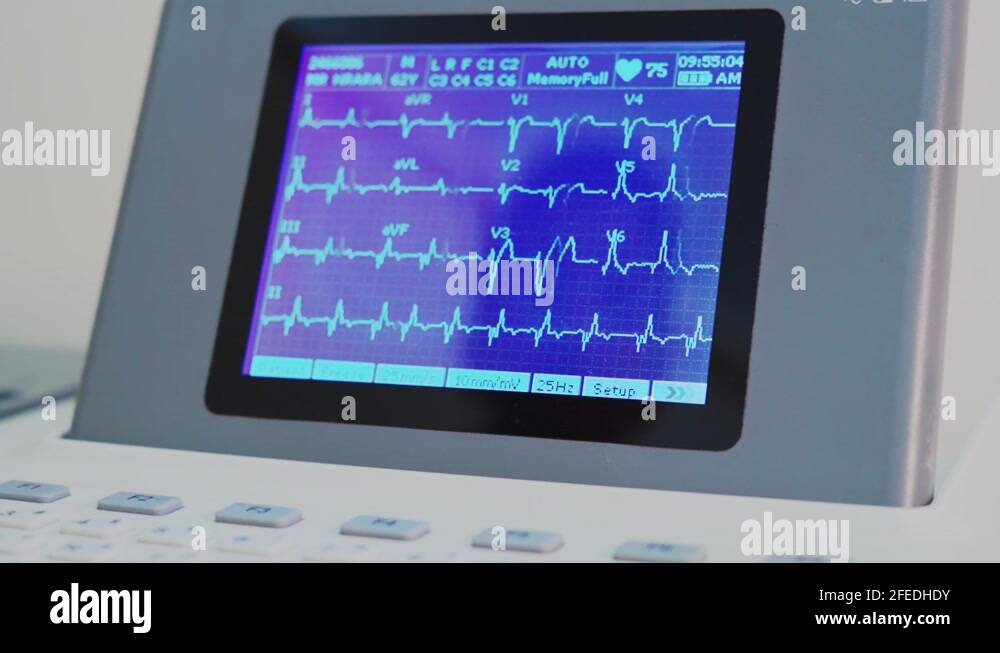 Ecg screen monitor Stock Videos & Footage - HD and 4K Video Clips - Alamy