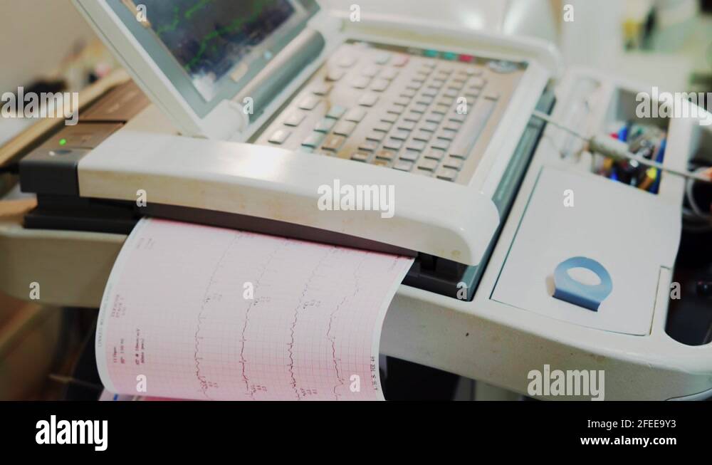 Ecg print out machine Stock Videos & Footage - HD and 4K Video Clips ...