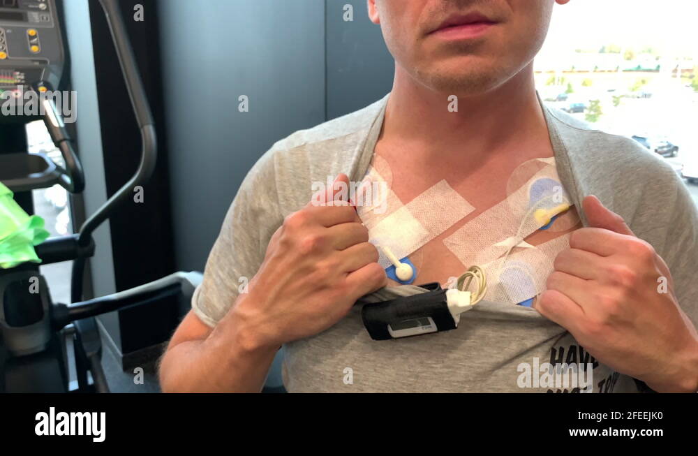 Holter ecg Stock Videos & Footage - HD and 4K Video Clips - Alamy