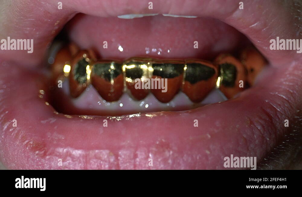 Gold teeth singer Stock Videos & Footage - HD and 4K Video Clips - Alamy