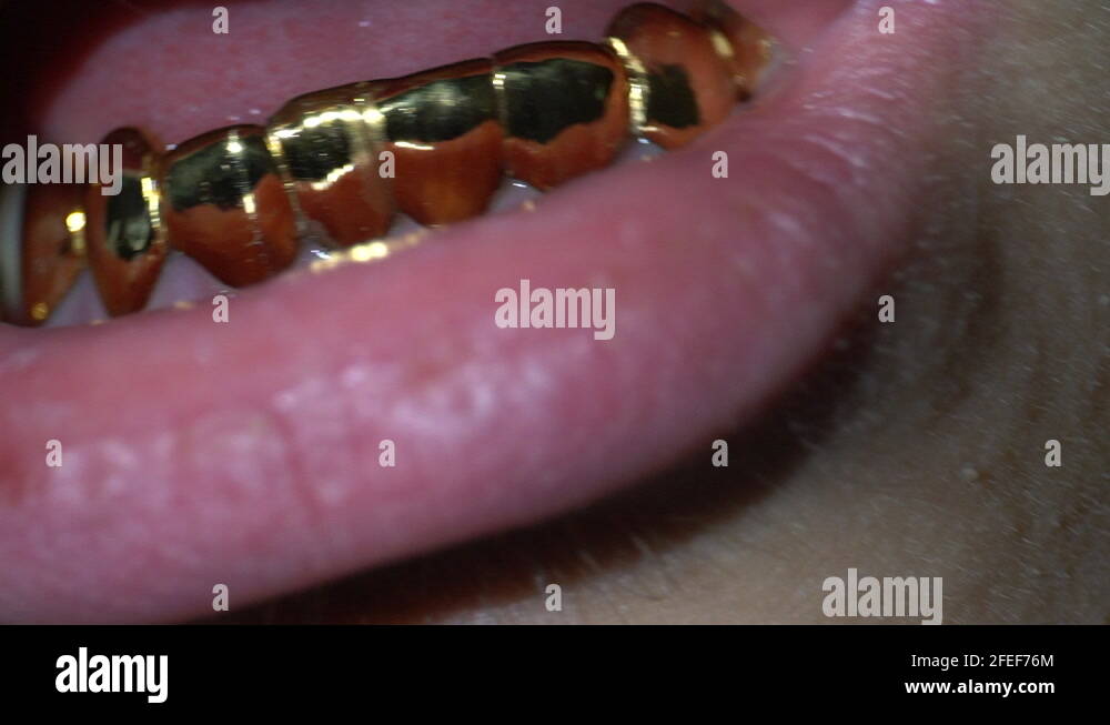 Golden Grillz in a male mouth, gold teeth, lips, left to rightement ...
