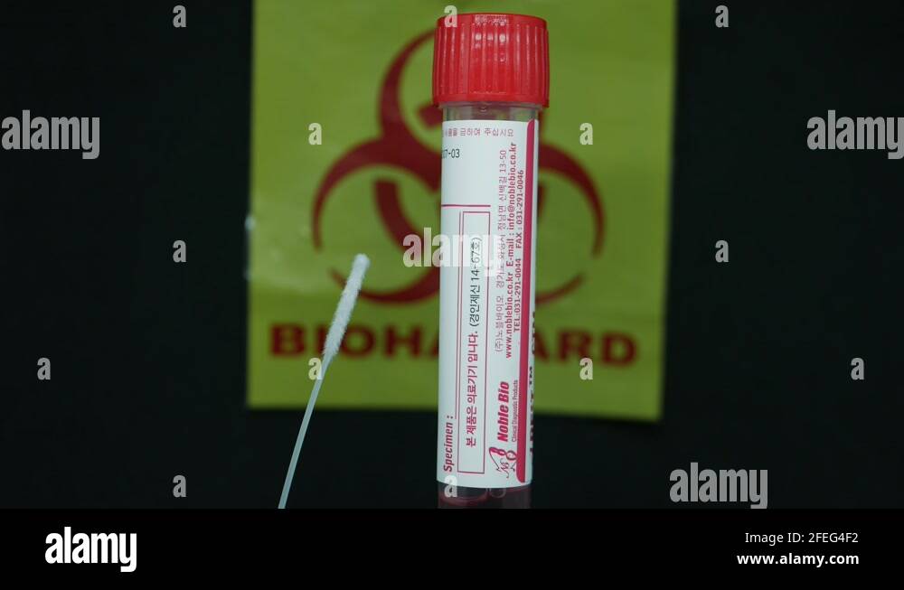 Biological sample collection Stock Videos & Footage - HD and 4K Video ...