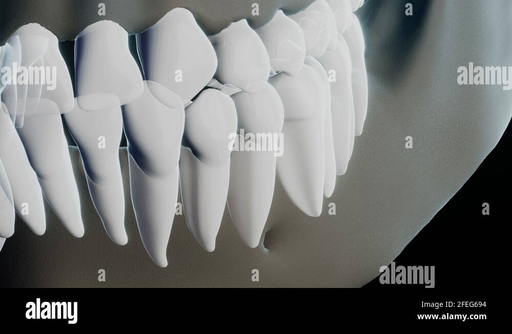 Molar tooth decay Stock Videos & Footage - HD and 4K Video Clips - Alamy