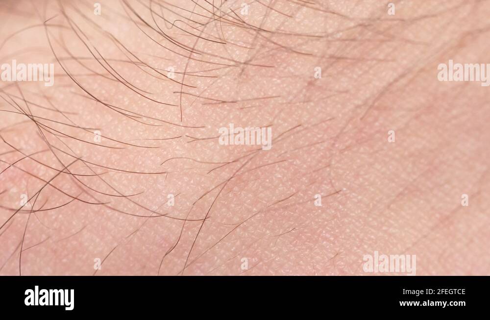 Human skin macro hair Stock Videos & Footage - HD and 4K Video Clips ...