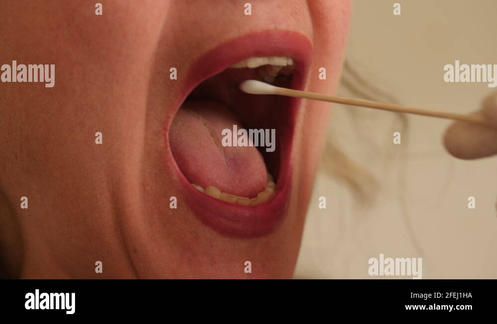 Oral swab sample Stock Videos & Footage - HD and 4K Video Clips - Alamy