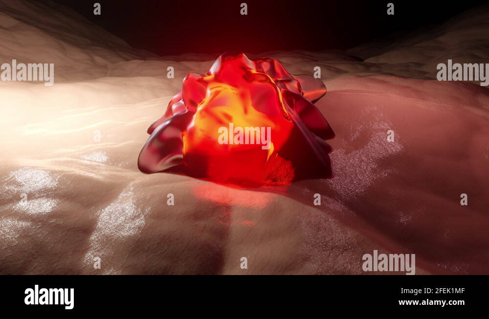 Malignant cancer cell Stock Videos & Footage - HD and 4K Video Clips ...