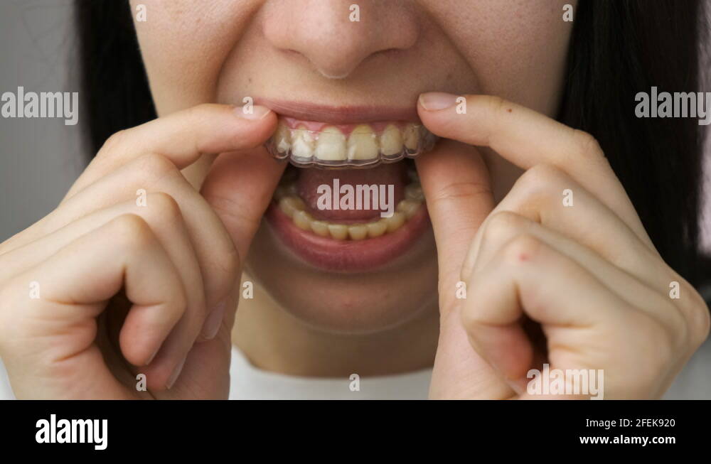 Jaw guard Stock Videos & Footage - HD and 4K Video Clips - Alamy