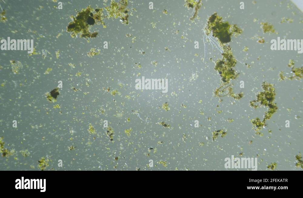 Pond water organisms microscope Stock Videos & Footage - HD and 4K ...