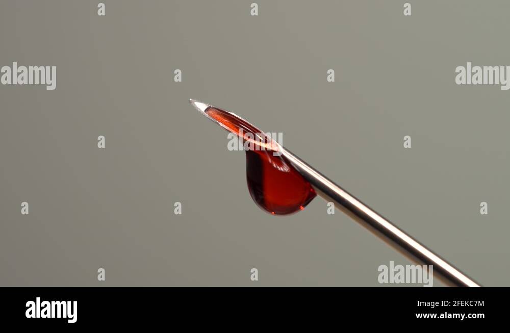 Drops of blood from the tip of the medical syringe. Bloody liquid ...