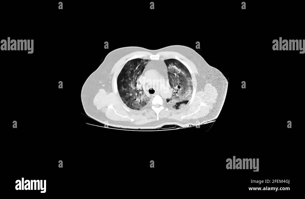 Computed tomography thorax Stock Videos & Footage - HD and 4K Video ...