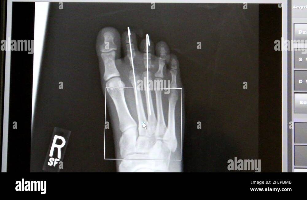 Gunshot bullet wound Stock Videos & Footage - HD and 4K Video Clips - Alamy