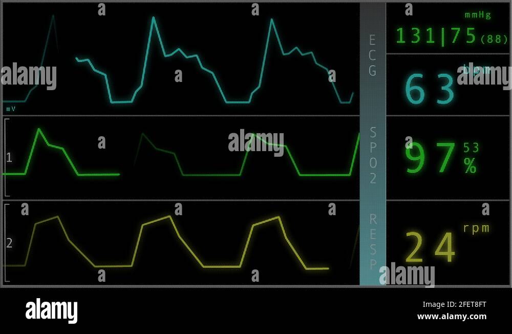 Electrodiagram Stock Videos & Footage - HD and 4K Video Clips - Alamy