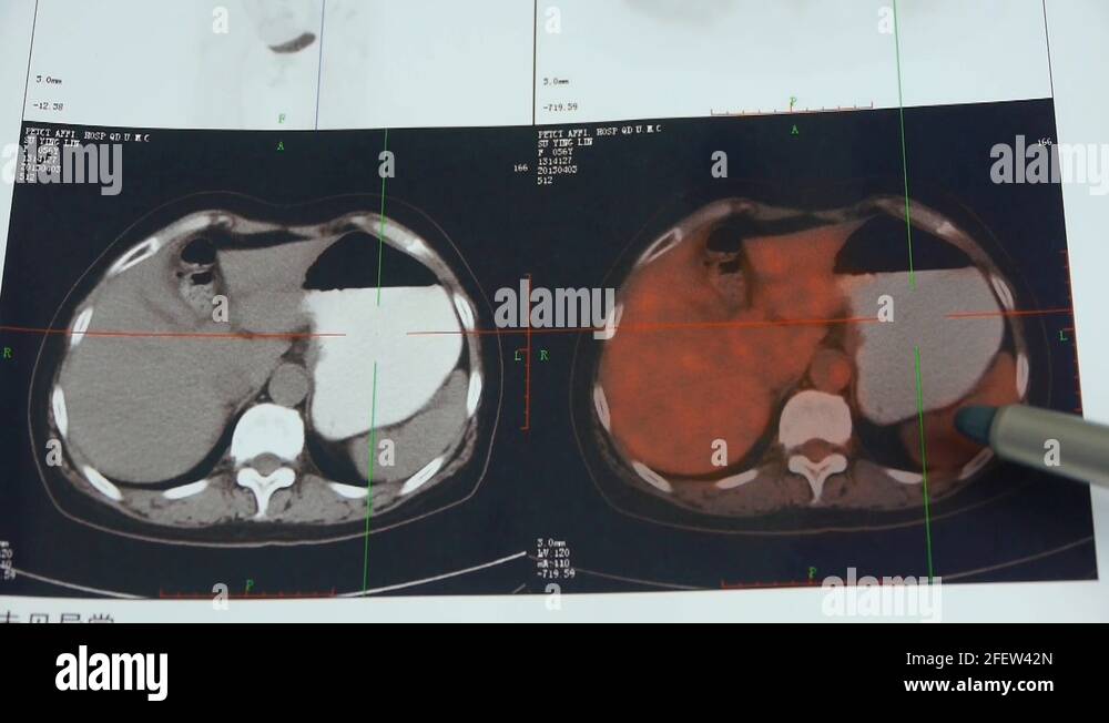 doctor study color stomach pet-ct scan,human organ X-ray radiography ...