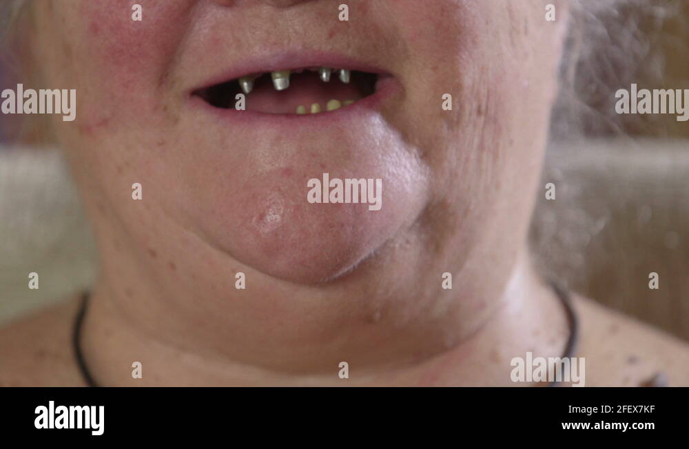 Toothless smile Stock Videos & Footage - HD and 4K Video Clips - Alamy