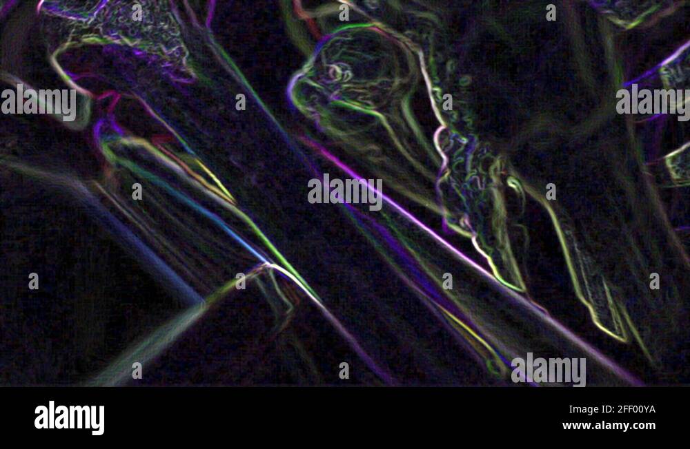 Roentgen xray Stock Videos & Footage - HD and 4K Video Clips - Alamy