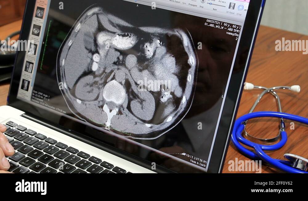 Review body Stock Videos & Footage - HD and 4K Video Clips - Alamy