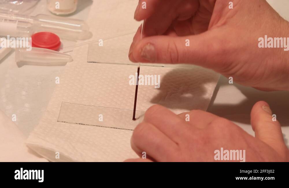 Wildlife vet south africa Stock Videos & Footage - HD and 4K Video ...