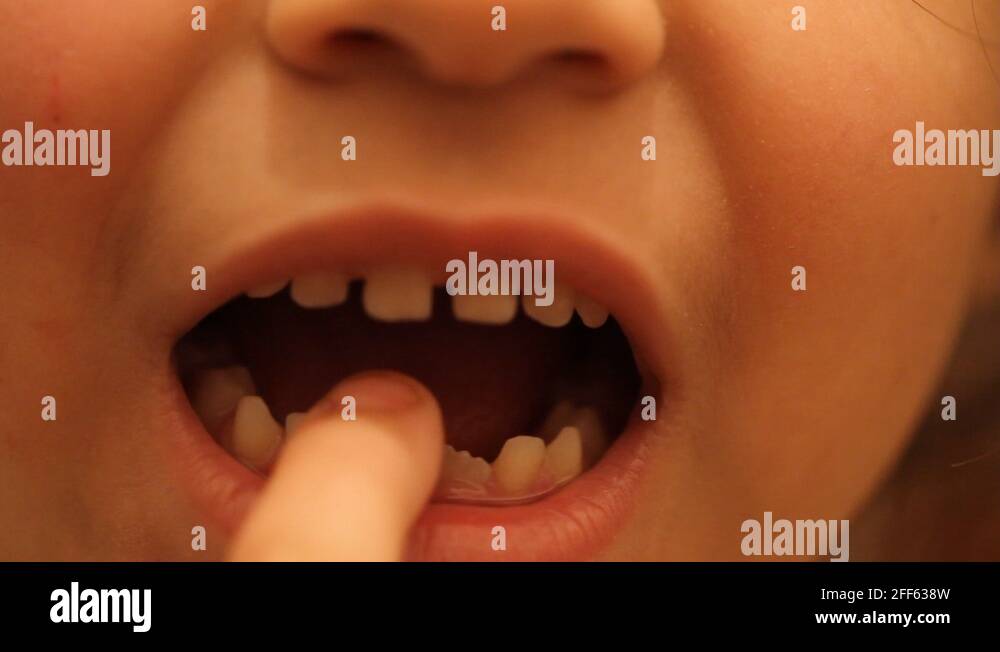 little Girl wiggles her first loose tooth Stock Video Footage - Alamy