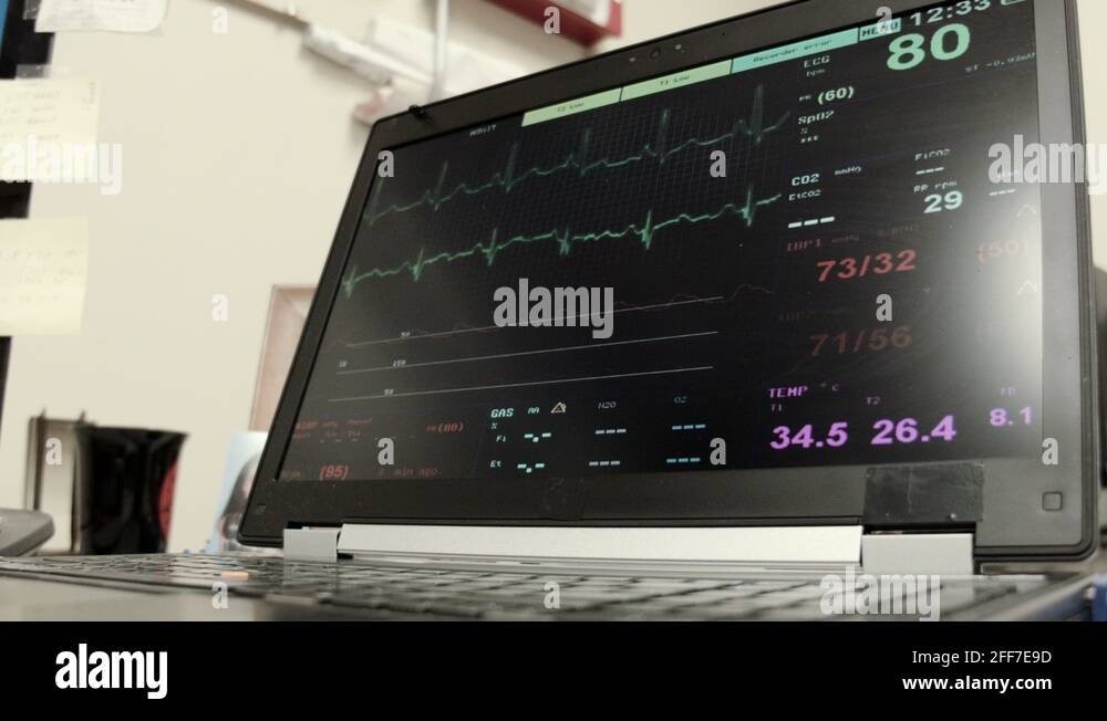 Portable ekg Stock Videos & Footage - HD and 4K Video Clips - Alamy