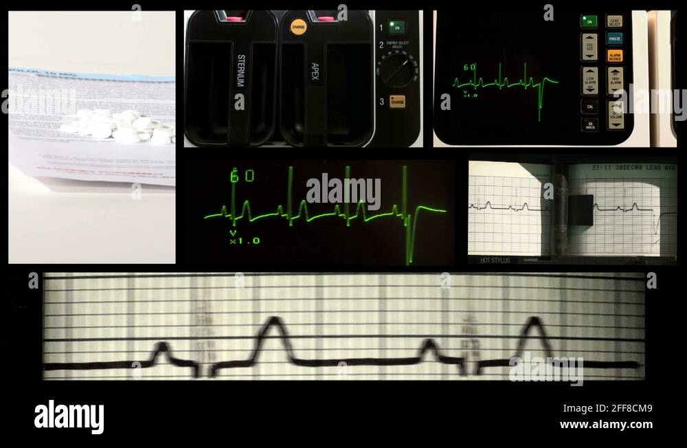 Ekg rate intensive care unit waveform first aid body trace healthcare ...