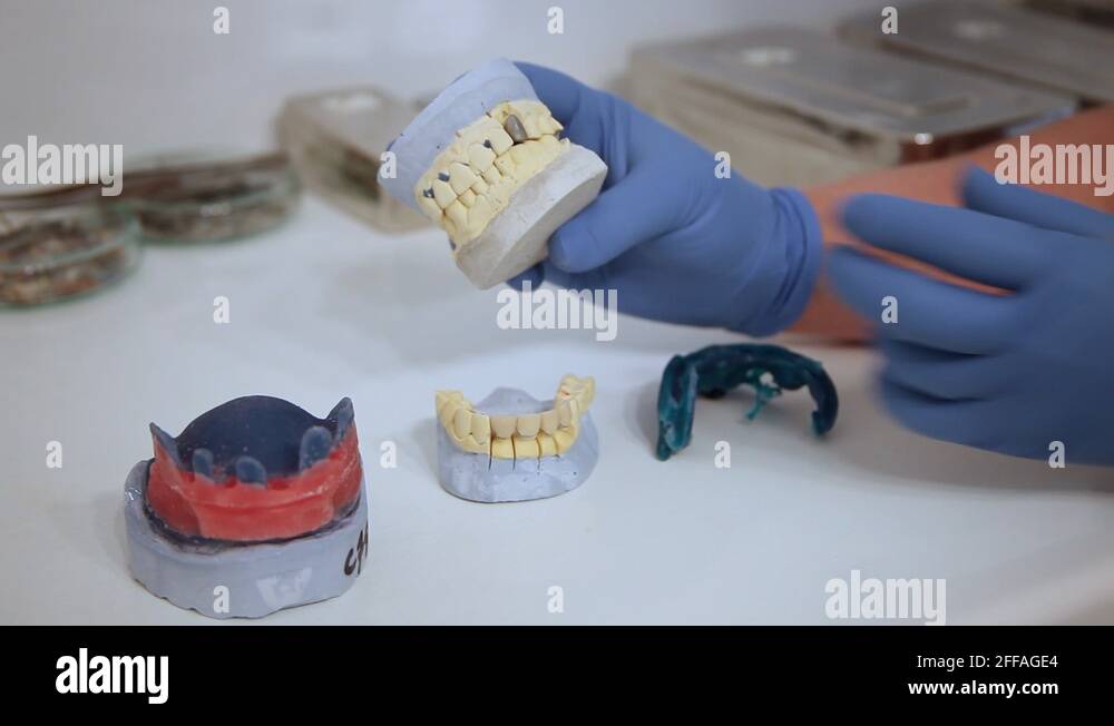 Removing teeth Stock Videos & Footage - HD and 4K Video Clips - Alamy