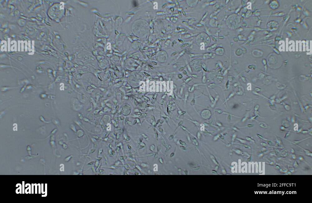 Phase contrast microscopy Stock Videos & Footage - HD and 4K Video ...