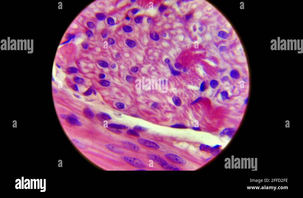 Human epithelial cell Stock Videos & Footage - HD and 4K Video Clips ...