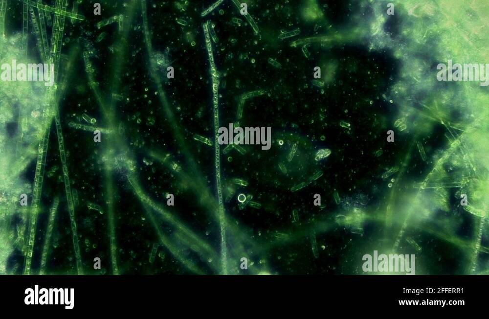 Moss plant microscope Stock Videos & Footage - HD and 4K Video Clips ...