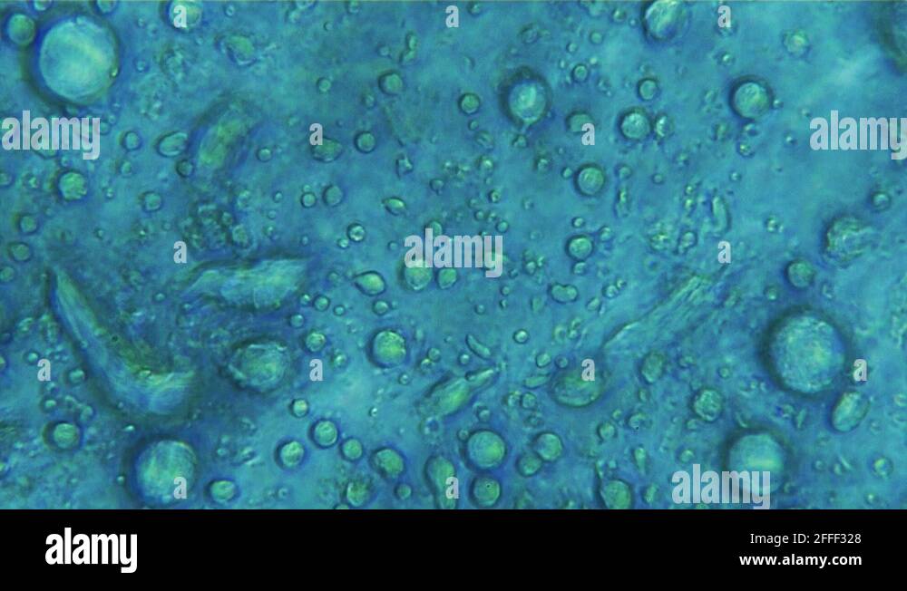 Yeast Fungi Organisms Under Microscope 100x Stock Footage Dry Active