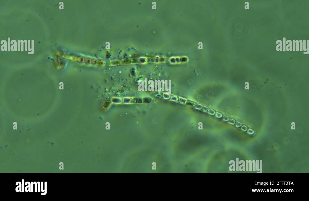 Bacteria microscope food Stock Videos & Footage - HD and 4K Video Clips ...